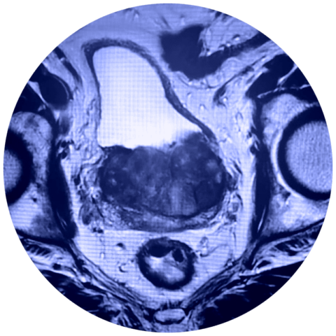 Multiparametric Prostate MRI | Scantibodies Imaging and Therapy